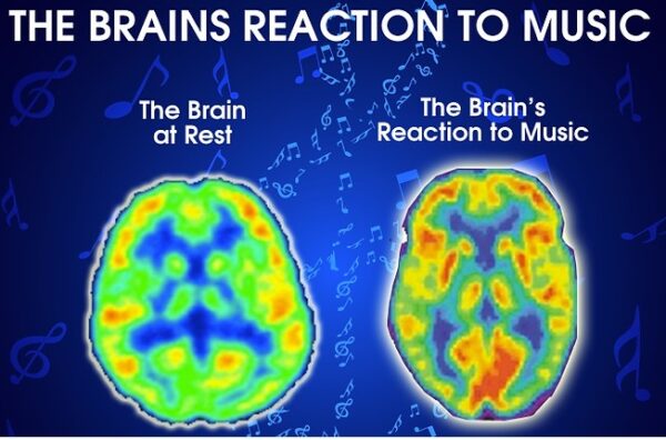 Exploring the Intricacies of Neurologic Music Therapy - Face The Music